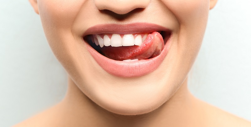 Exclusive technology and marketing collaboration for sublingual delivery