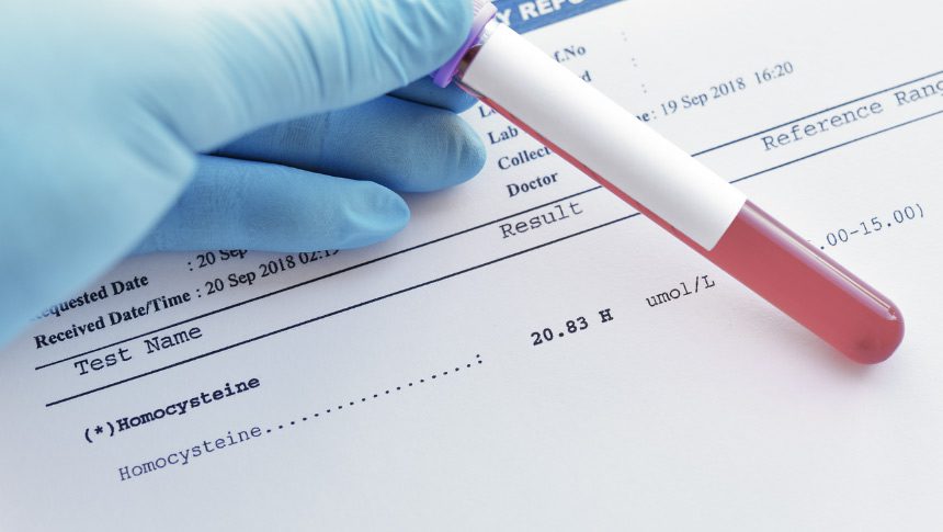 High homocysteine: what it is, why it happens and how to... | CPHI Online