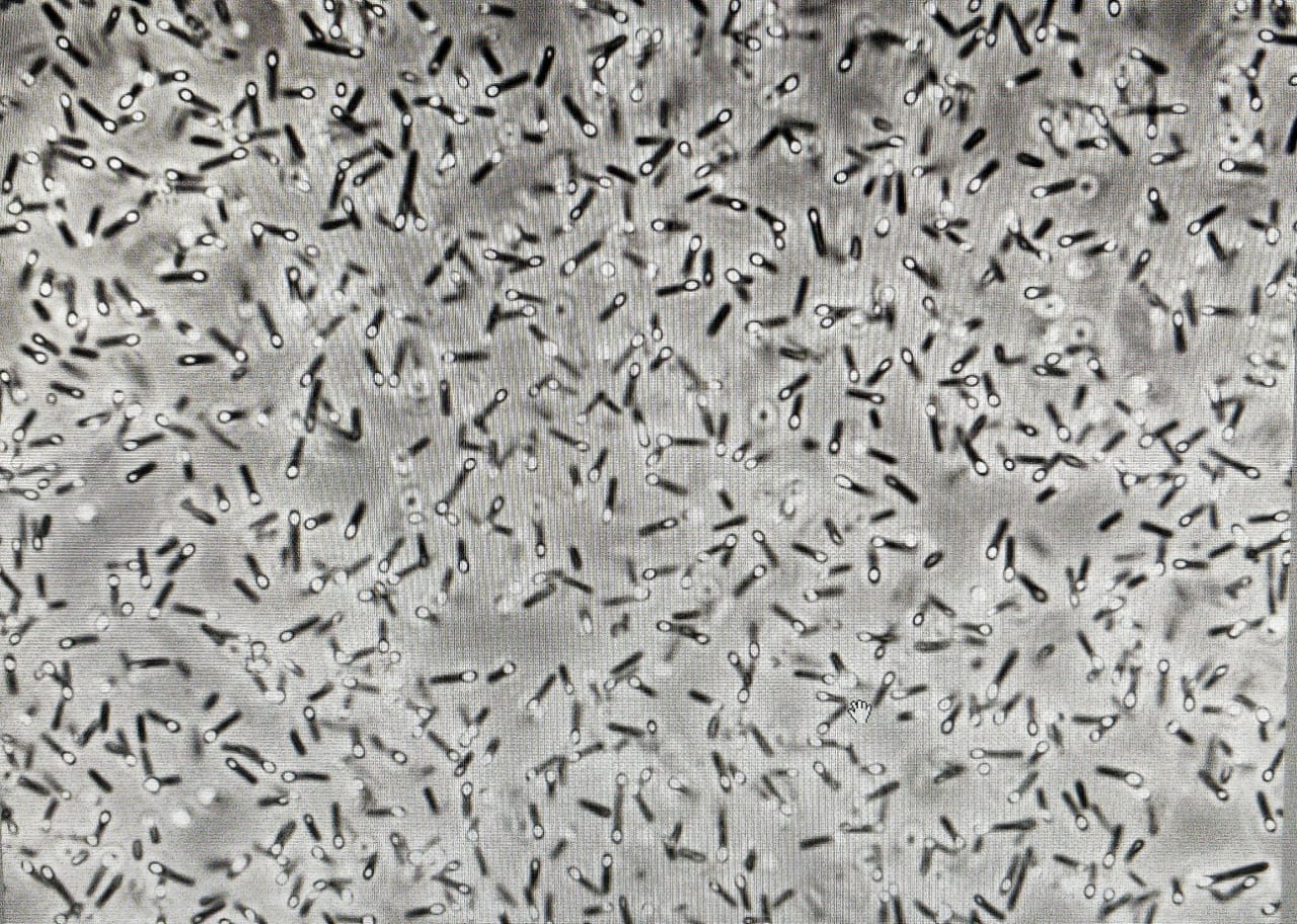 Bacillus clausii | Advanced Vital Enzymes Pvt Ltd | CPHI Online