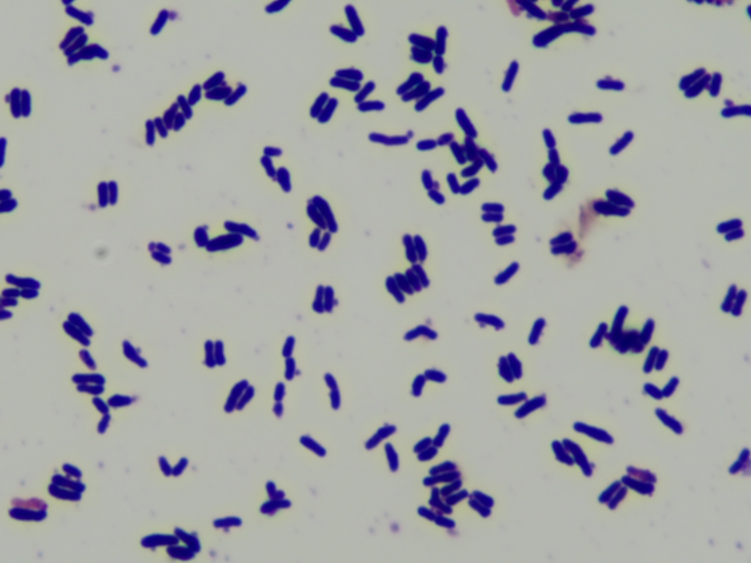 Bifidobacterium animalis subsp. lactis | CPHI Online